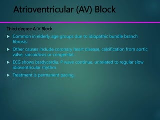 Atrioventricular node by sarathkumar bsx | PPTX