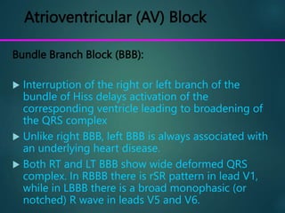 Atrioventricular node by sarathkumar bsx | PPT
