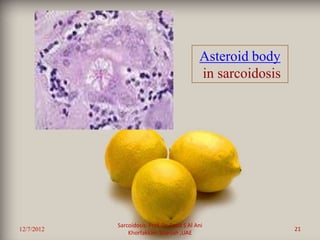 Sarcoidosis | PPTX