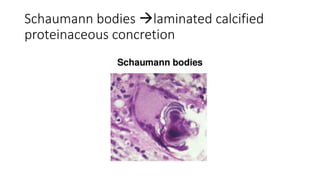 Sarcoidosis revision notes | PPT