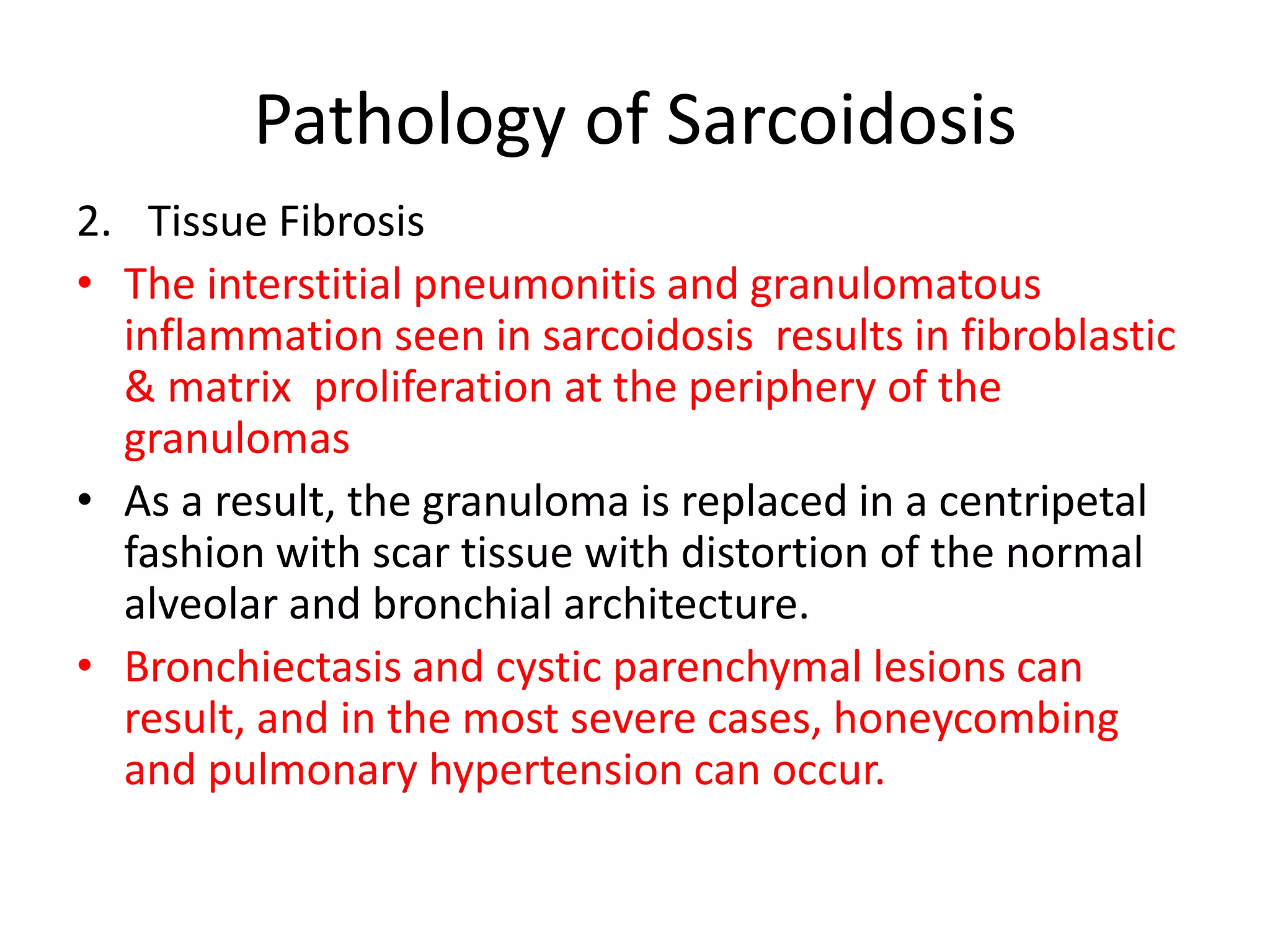 Sarcoidosis | PPT