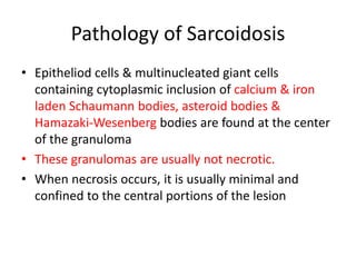 Sarcoidosis | PPTX