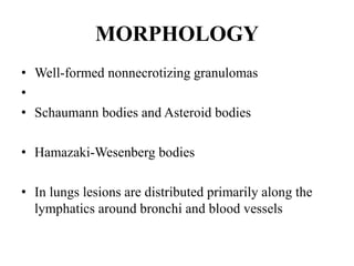 Sarcoidosis | PPT