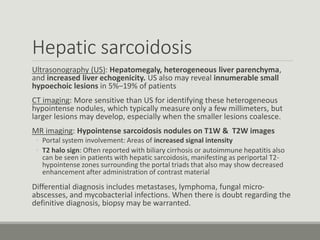 Sarcoidosis from head to toe: What the radiologist needs to know | PPTX