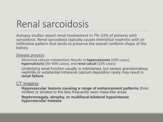 Sarcoidosis from head to toe: What the radiologist needs to know | PPTX