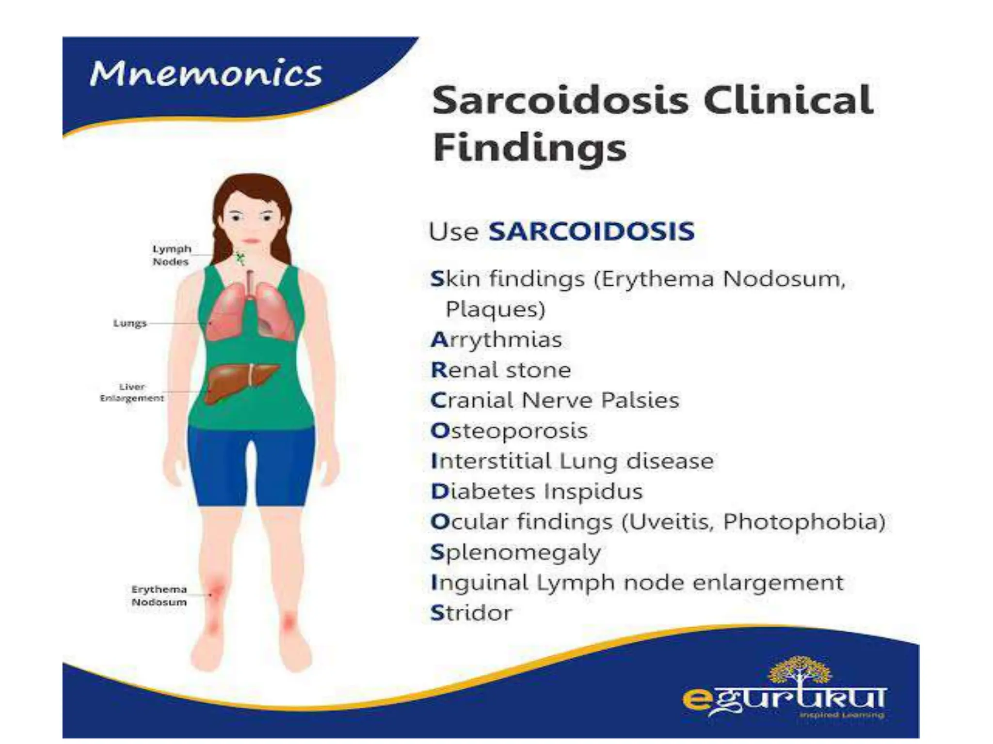 sarcoidosis chest xray and hrct findings | PPTX