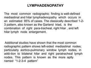 sarcoidosis chest xray and hrct findings | PPTX