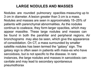 sarcoidosis chest xray and hrct findings | PPTX