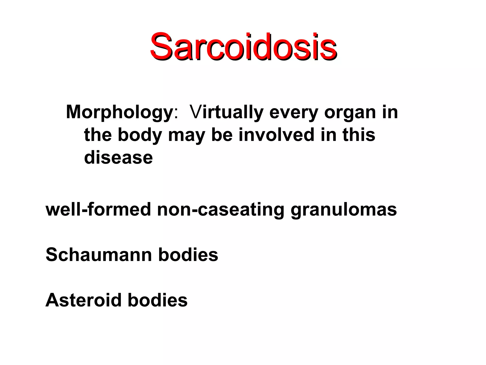 Sarcoidosis | PDF