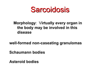 Sarcoidosis | PPT