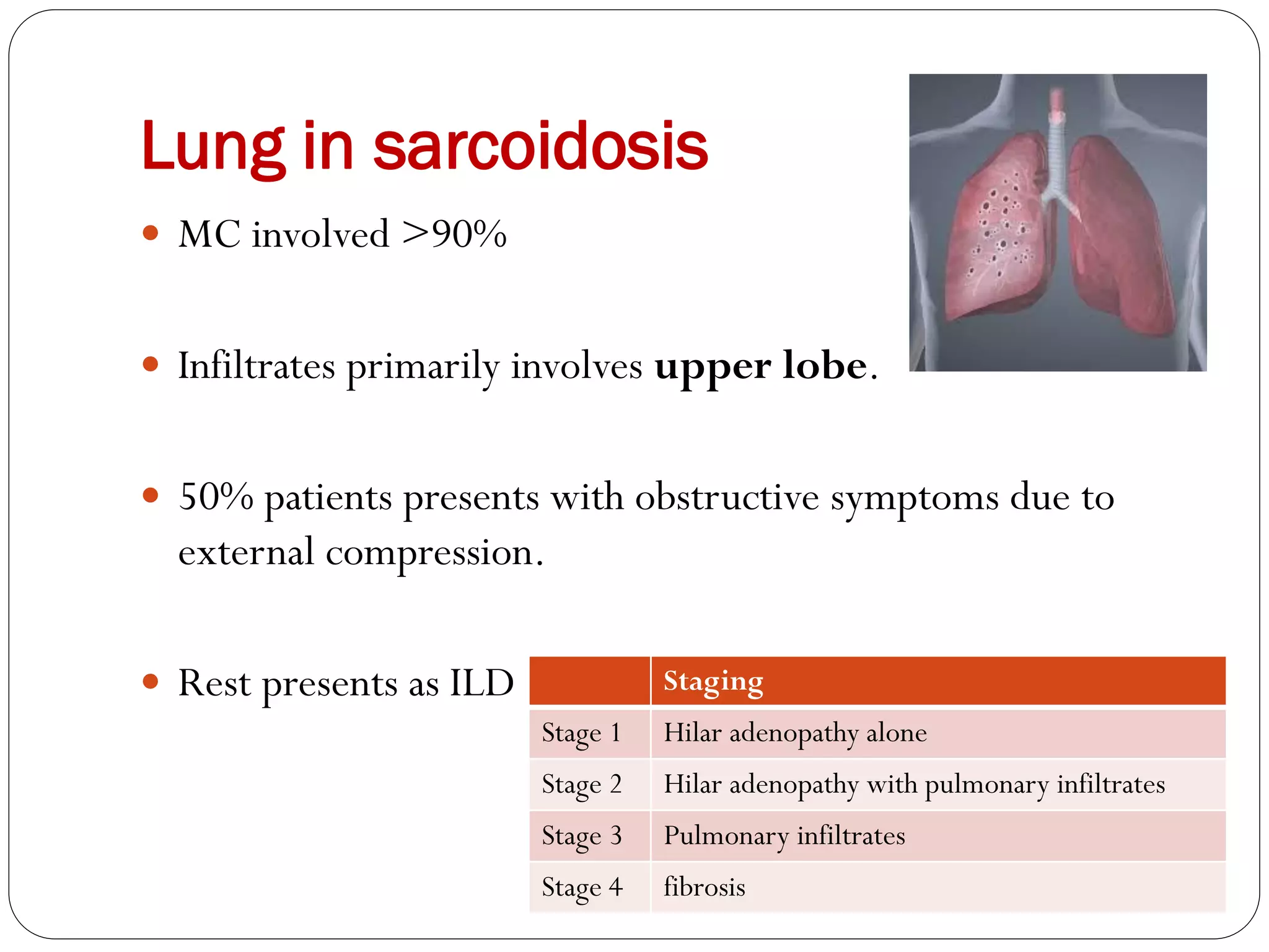 Sarcoidosis | PDF