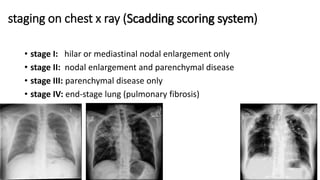 Sarcoidosis | PPTX