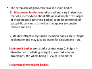 SARCOIDOSIS | PPT