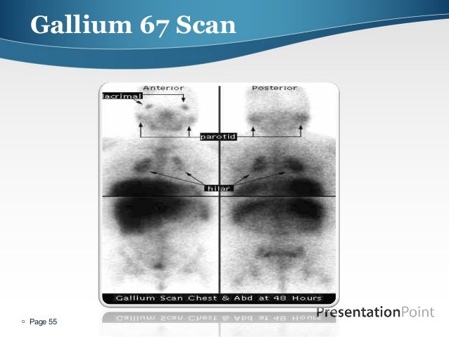 Sarcoidosis & orphan lung disease