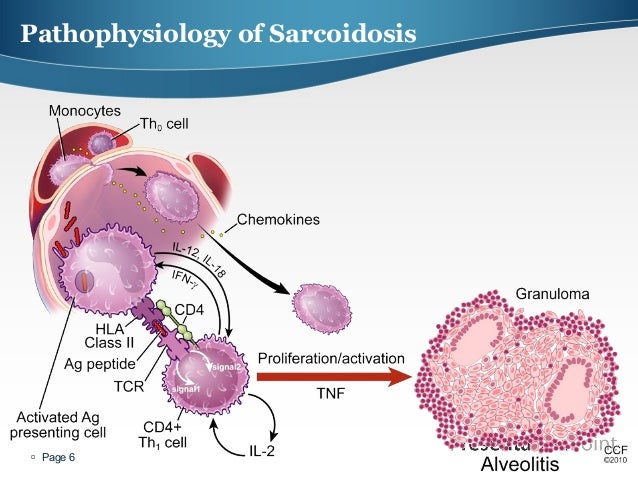 Sarcoidosis & orphan lung disease