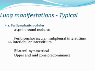 IMAGING IN SARCOIDOSIS | PPTX