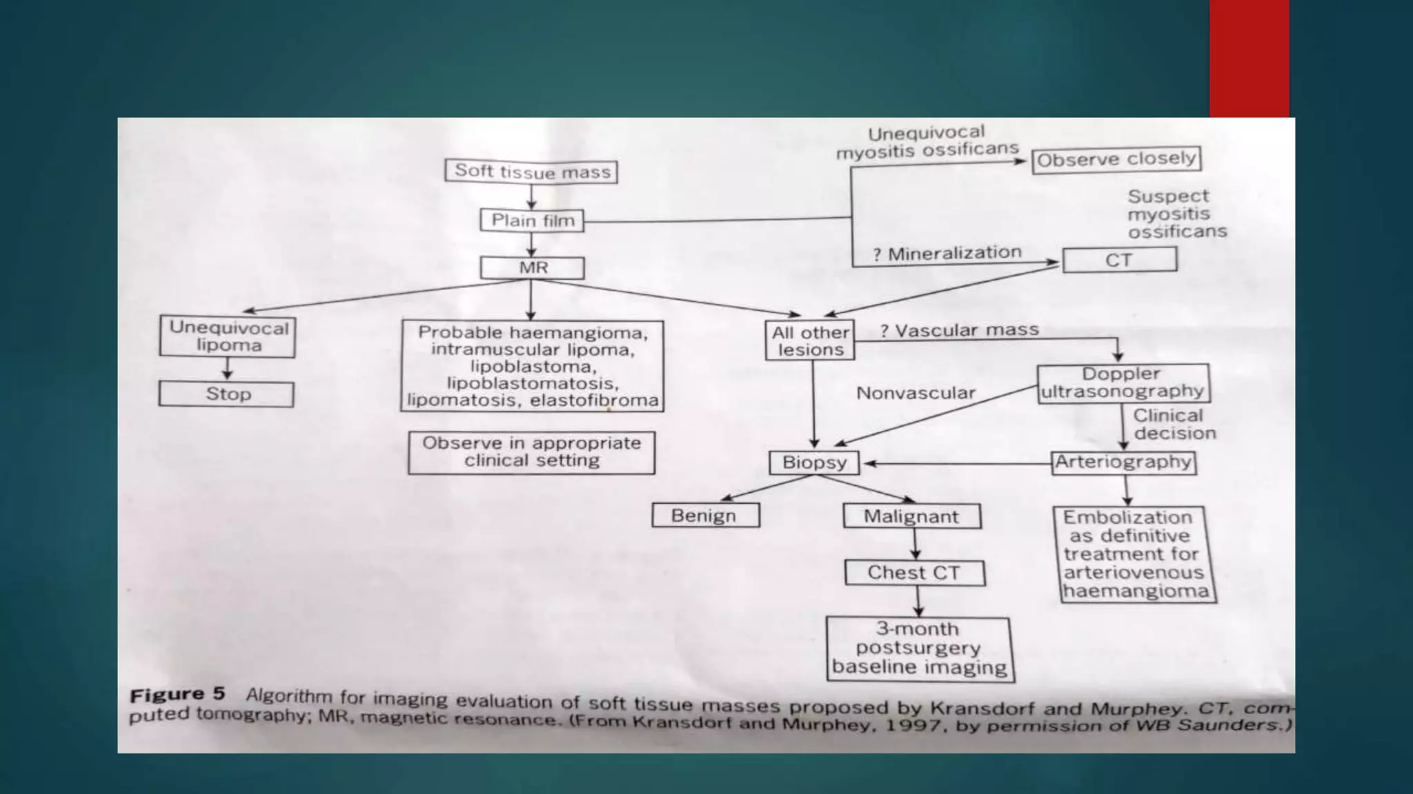 Sarcoma Pptx