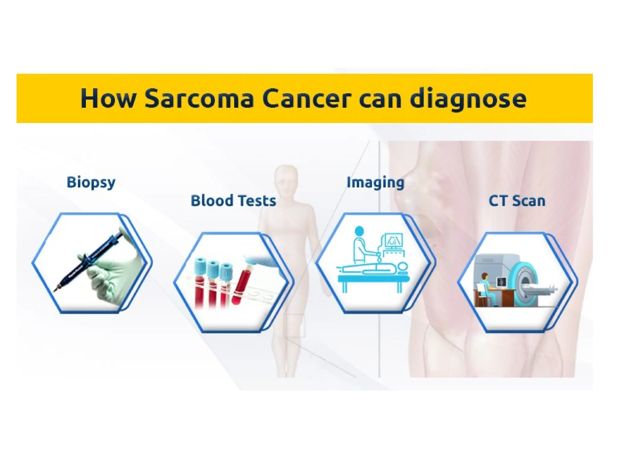 SARCOMA types and categories path. Docu | PPTX