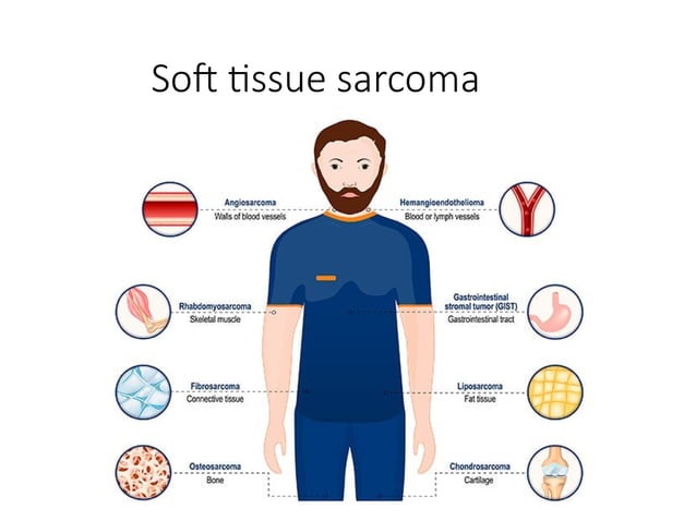 SARCOMA types and categories path. Docu | PPTX