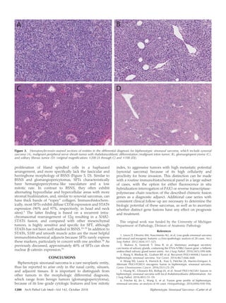 Sarcoma bifenotipic sinonasal review | PDF