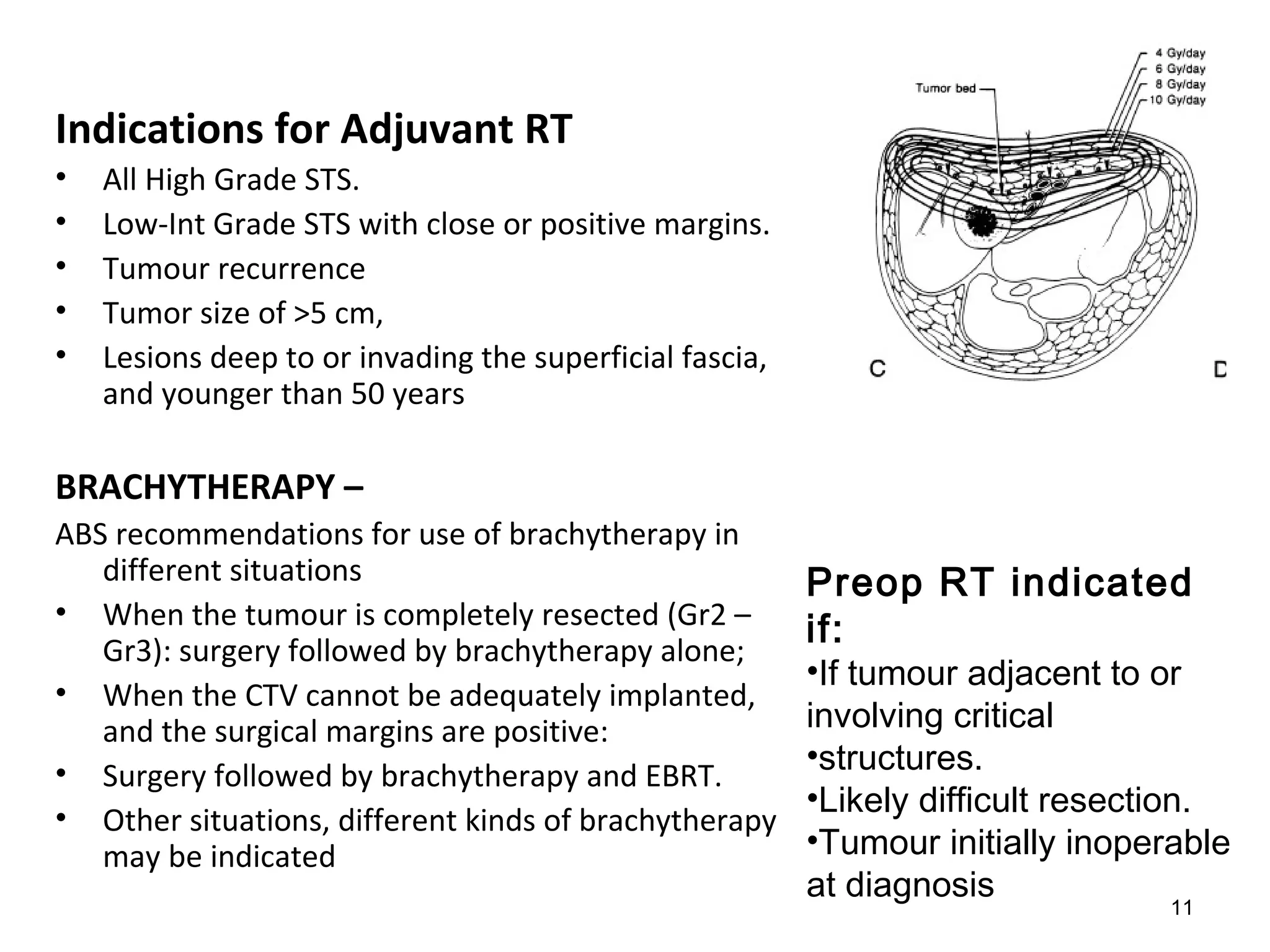 Sarcoma brachytherapy updates | PPT