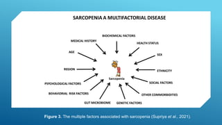 Sarcopenia - physiotherapy, symptoms.pptx