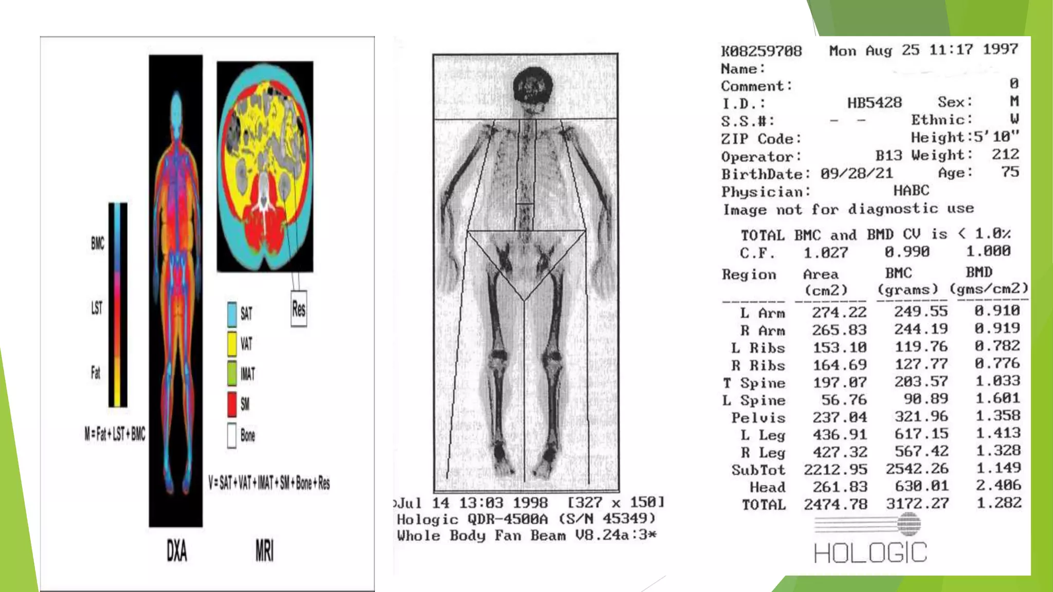 Sarcopenia in surgery.dr quiyum | PPTX | Endocrine and Metabolic ...