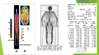 Sarcopenia in surgery.dr quiyum | PPTX