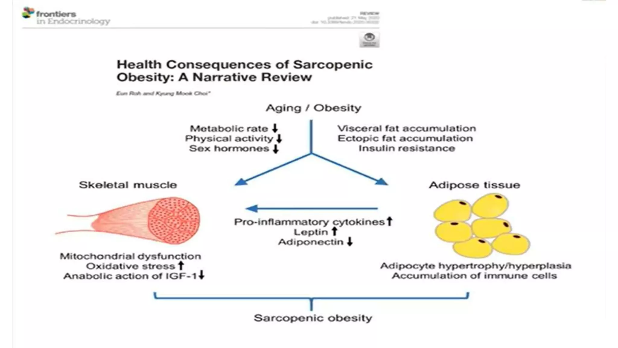 Sarcopenic Obesity.pptx