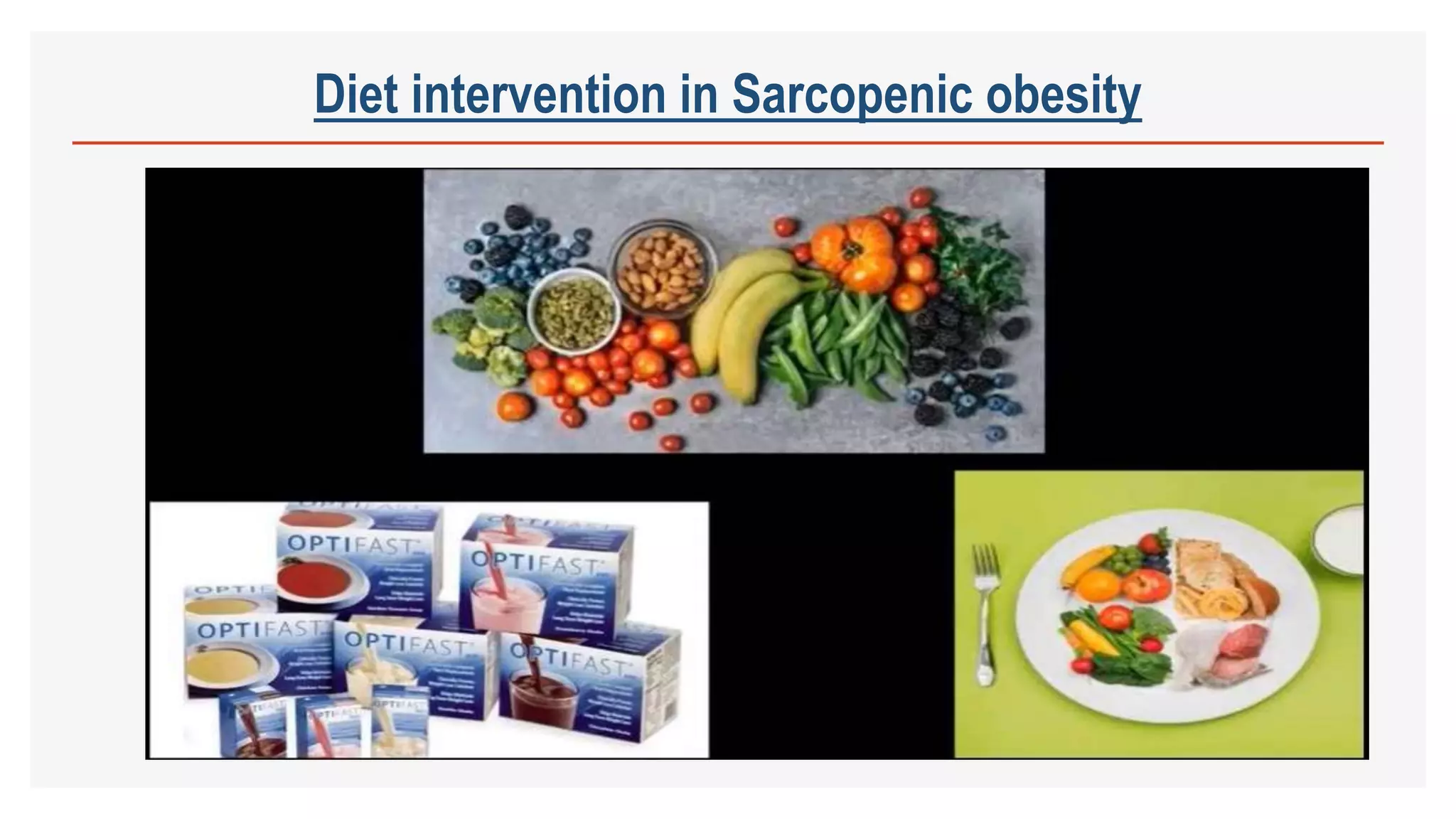 Sarcopenic Obesity.pptx
