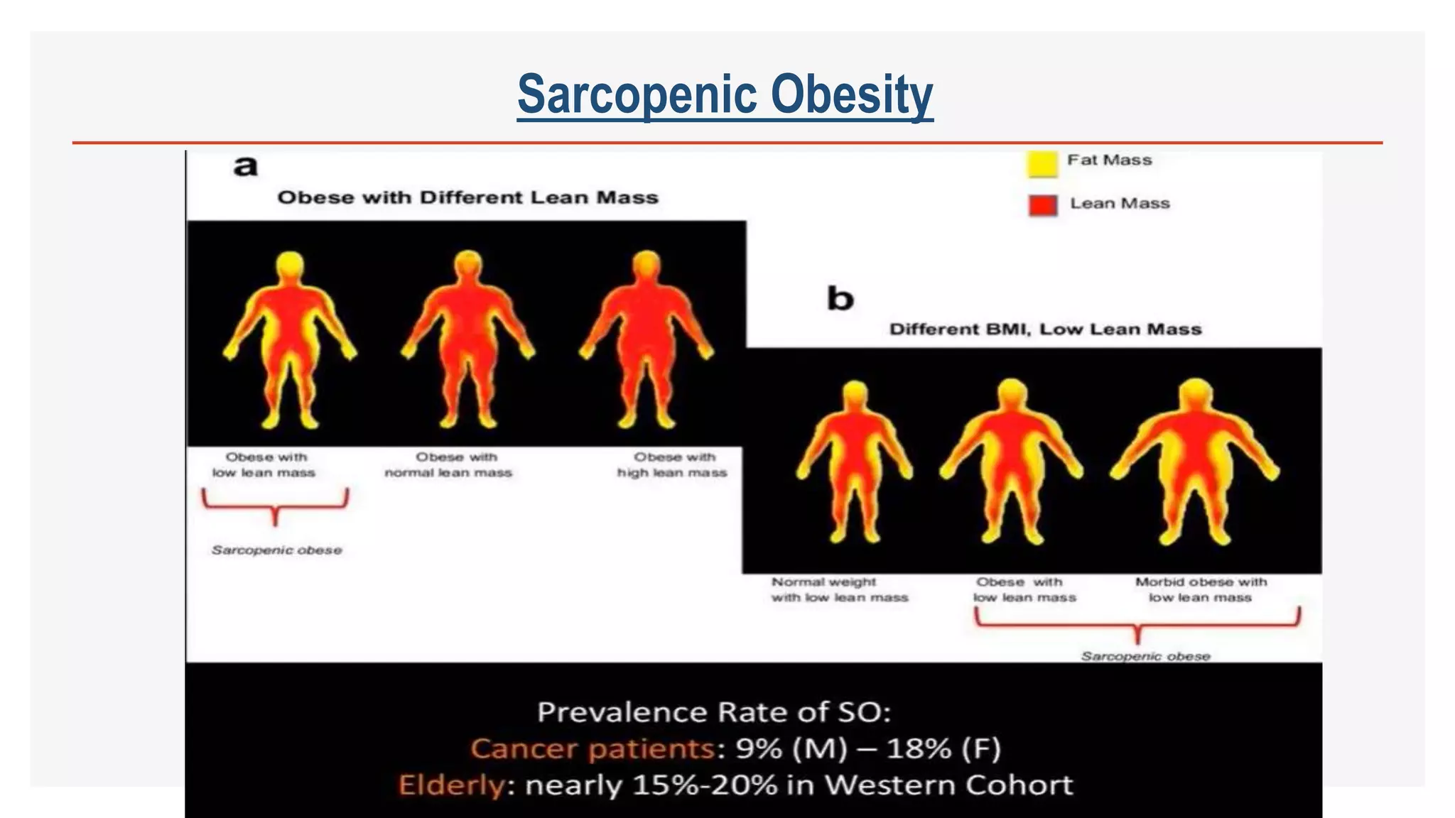 Sarcopenic Obesity.pptx