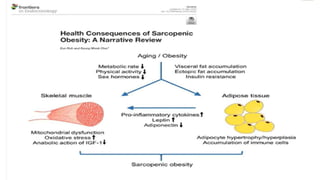 Sarcopenic Obesity.pptx