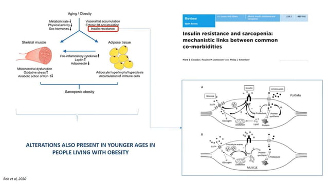 Sarcopenic Obesity.pptx