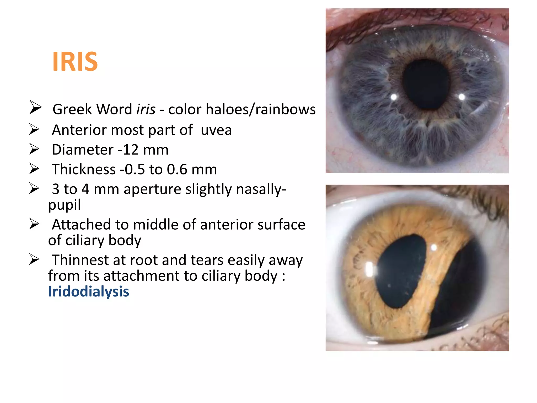 Uvea: Anatomy, Nerve & Vascular Supply, Clinical Correlation | PPTX