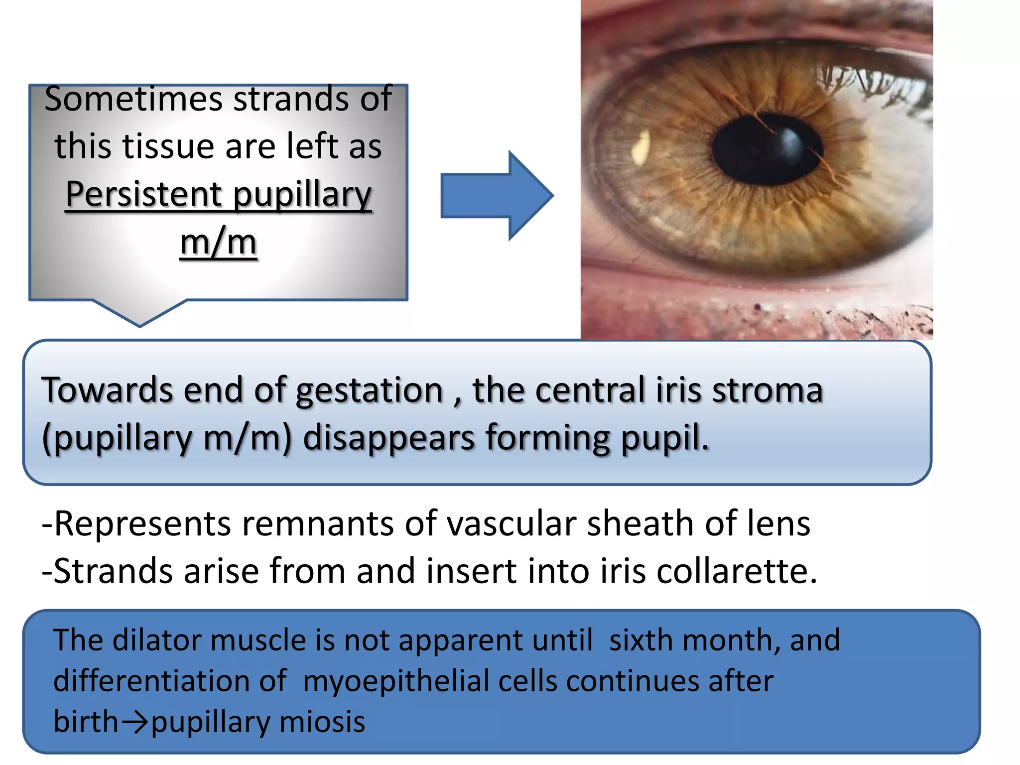 Uvea: Anatomy, Nerve & Vascular Supply, Clinical Correlation | PPTX