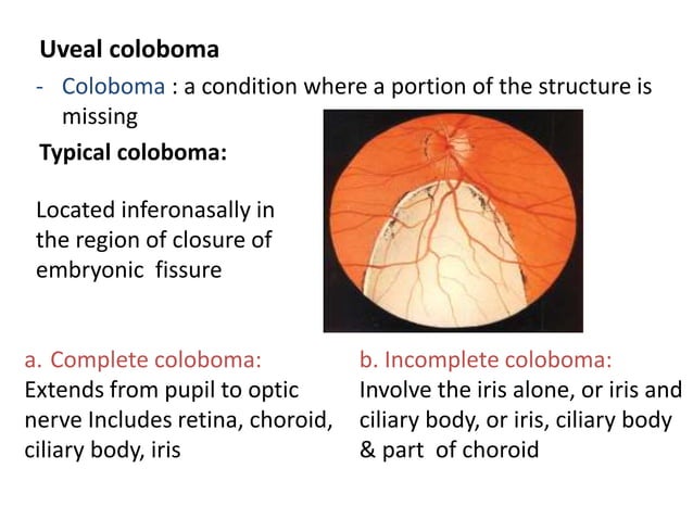 Uvea: Anatomy, Nerve & Vascular Supply, Clinical Correlation | PPTX ...