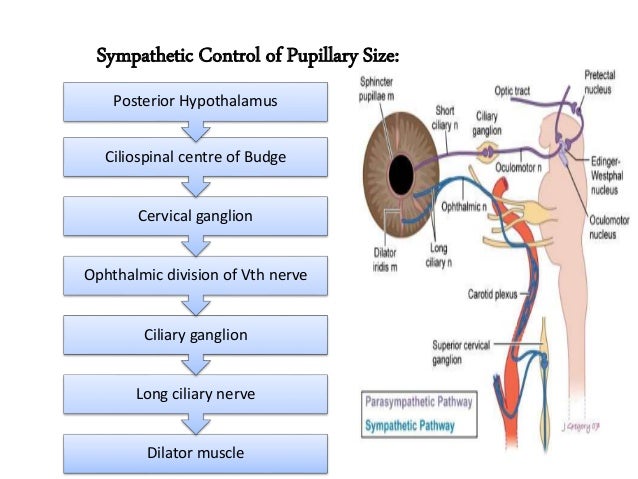 Uvea: Anatomy, Nerve & Vascular Supply, Clinical Correlation