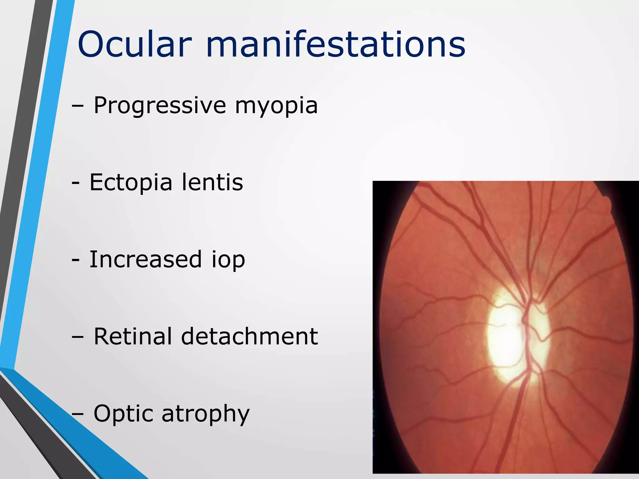 Eye in Metabolic Disorders | PPTX