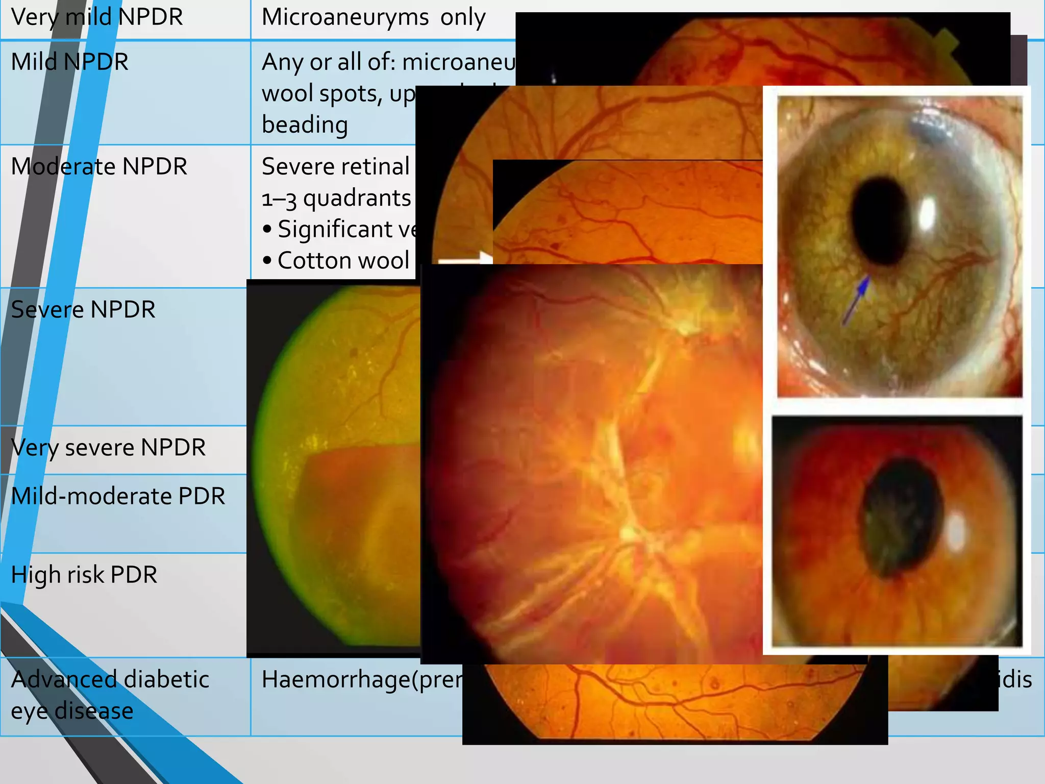 Eye in Metabolic Disorders | PPTX
