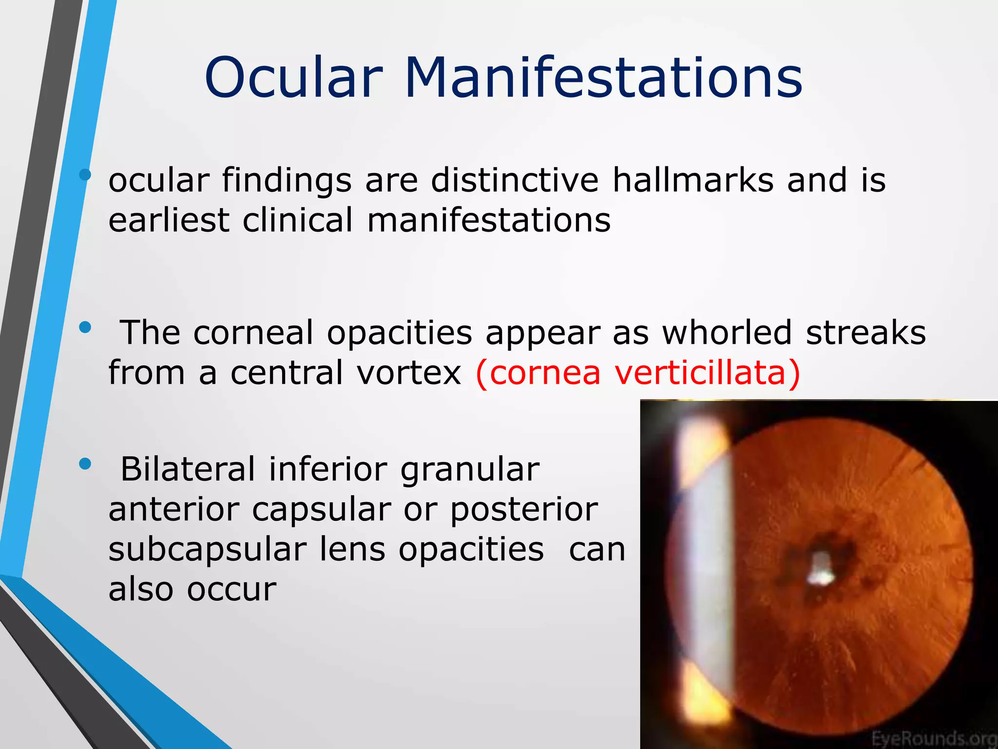 Eye in Metabolic Disorders | PPTX