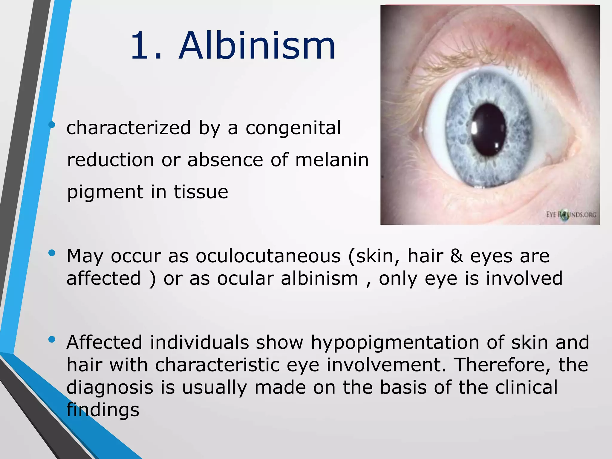 Eye in Metabolic Disorders | PPTX