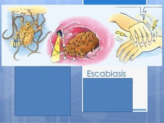 la Sarna o escabiosis | PPT