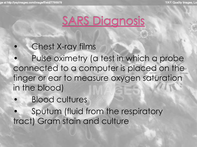 Sars | PPTX | Infectious Diseases | Diseases and Conditions