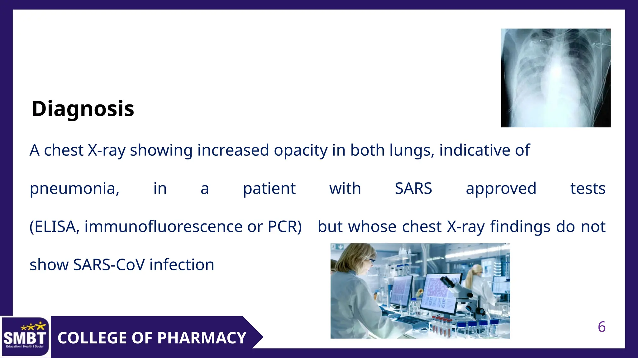 SARS(Severe Acute Respiratory Syndrome) .pptx