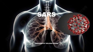 SARS (SEVERE ACUTE RESPIRATORY SYNDROME).pdf
