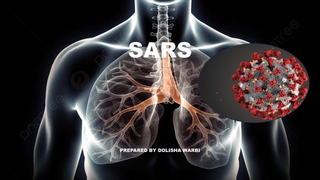 SARS (SEVERE ACUTE RESPIRATORY SYNDROME).pdf