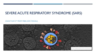 SEVERE ACUTE RESPIRATORY SYNDROME - COMMUNITY MEDICINE MBBS 2024 | PPT