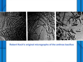 SARS Anthrax.pptx in tropical disease course | PPT