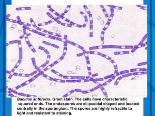 SARS Anthrax.pptx in tropical disease course | PPT