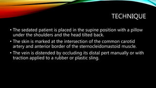 Jugular venography | PPTX